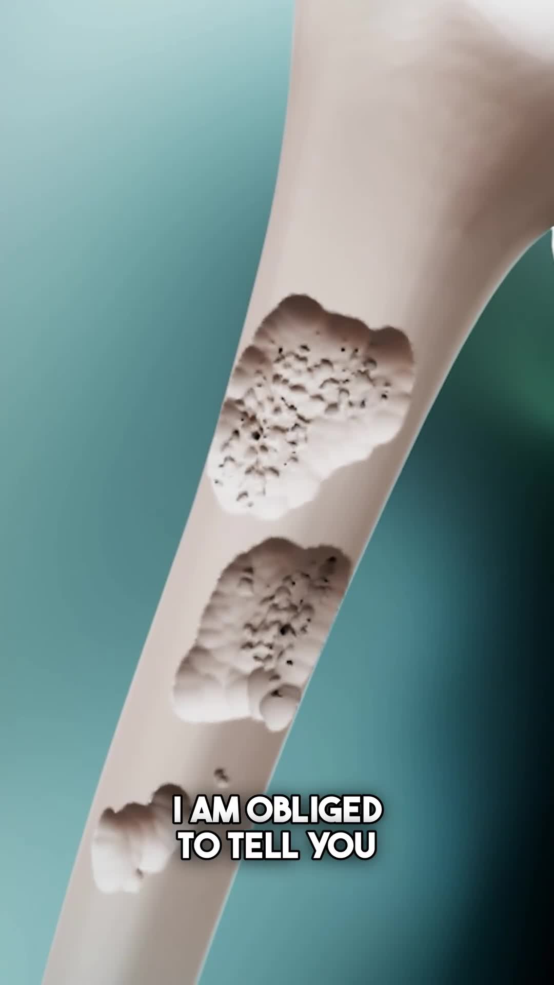 Lister Metropolis Laboratory in Mint,Chennai - Blood Testing Centres ...