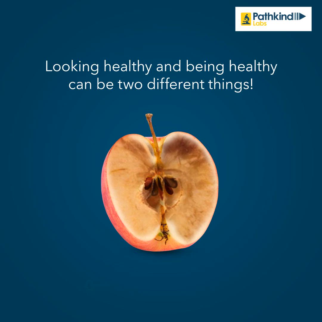 Pathkind Labs in Naini,Allahabad - Pathology Labs near me in Allahabad ...