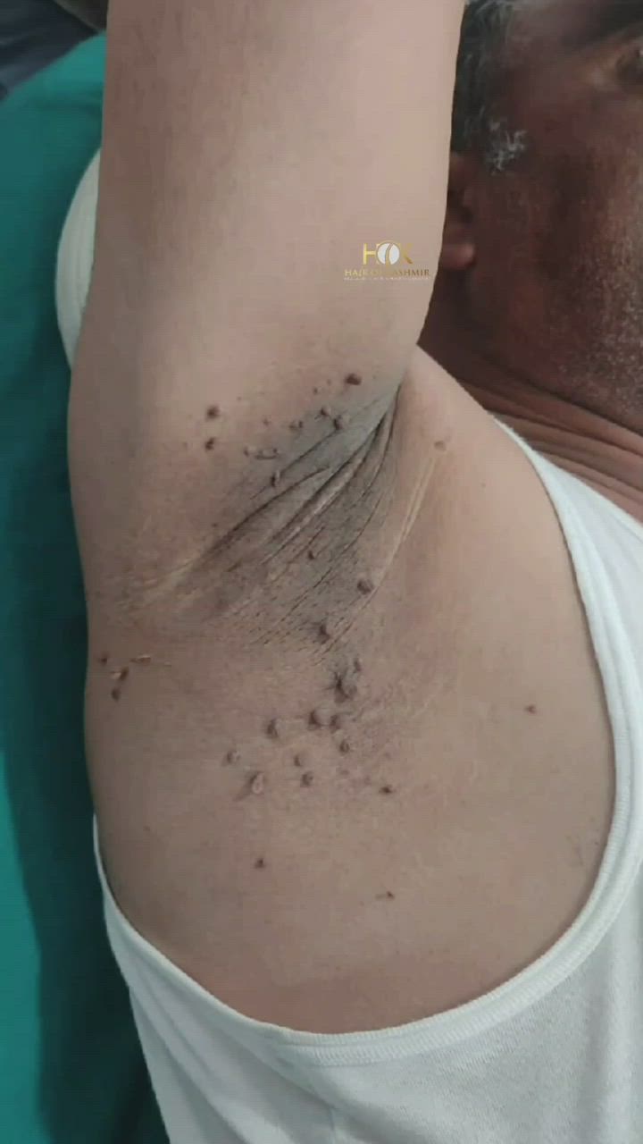 HAIR OF KASHMIR in Lal Nagar,Srinagar - 𝗕𝗼𝗼𝗸 𝗔𝗽𝗽𝗼𝗶𝗻𝘁𝗺𝗲𝗻𝘁 𝗢𝗻𝗹𝗶𝗻𝗲 - Best ...