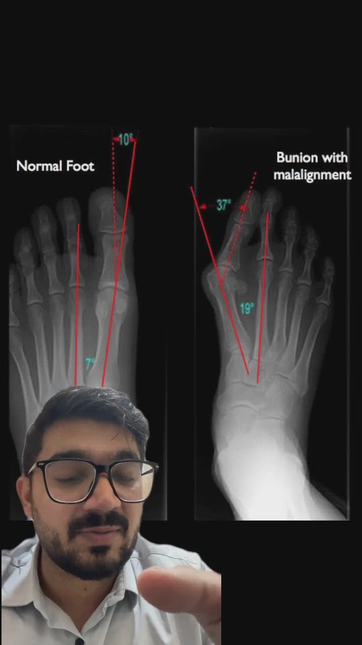 Ankle Foot Solutions (Afs) Chandigarh in Chandigarh Sector 20C ...